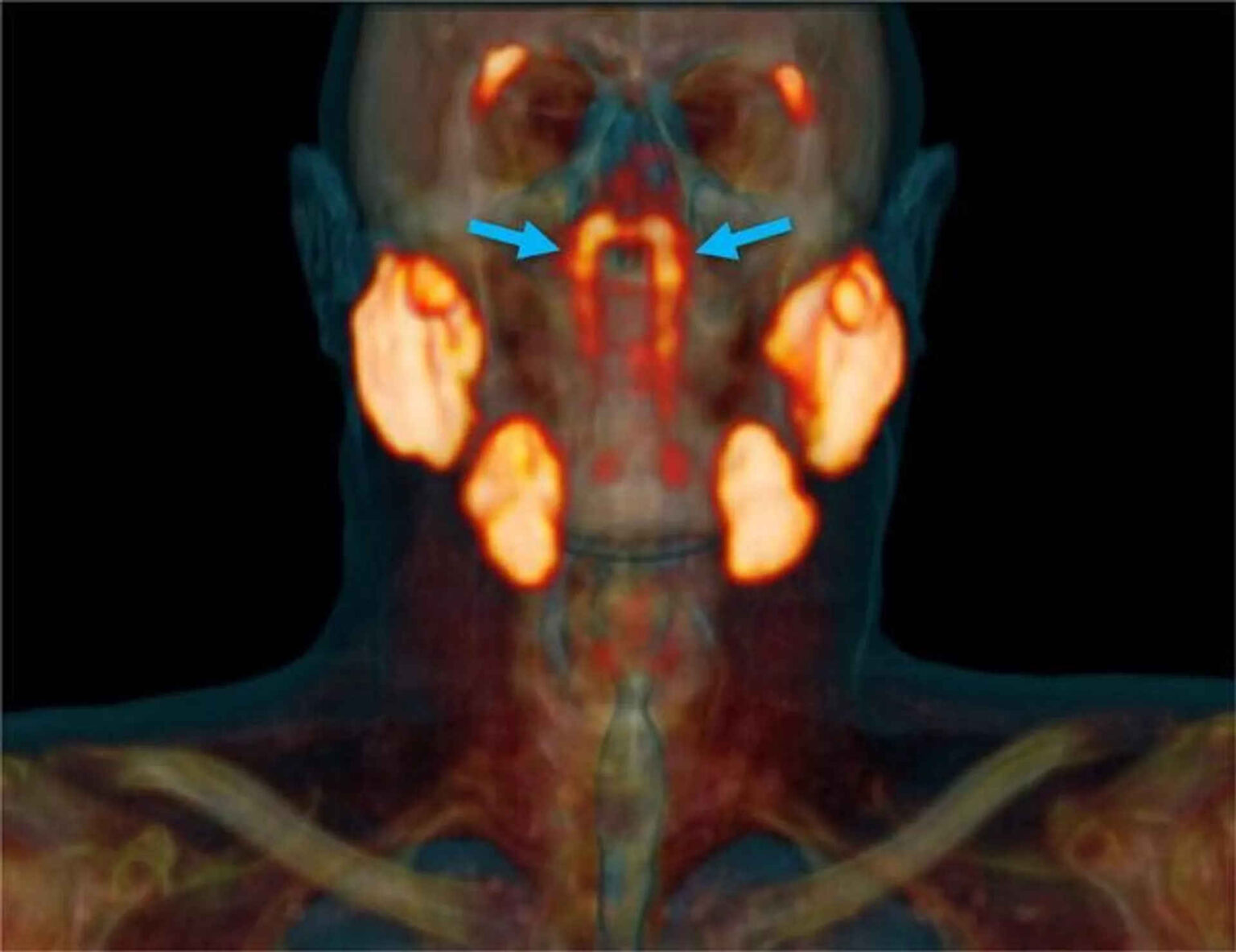Scientists Discover New Organ in Human Body - Daily Telegraph NZ