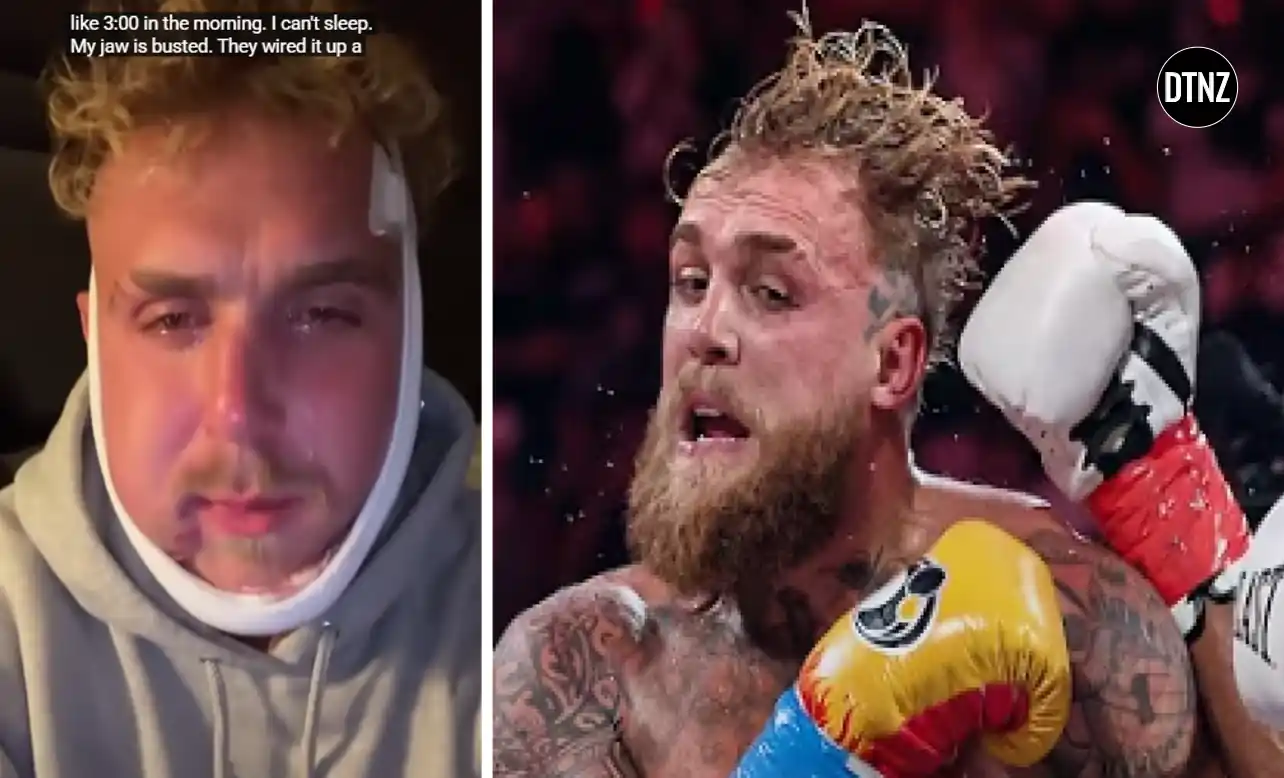 Jake Paul undergoes jaw surgery to fit titanium plates - Daily Telegraph NZ